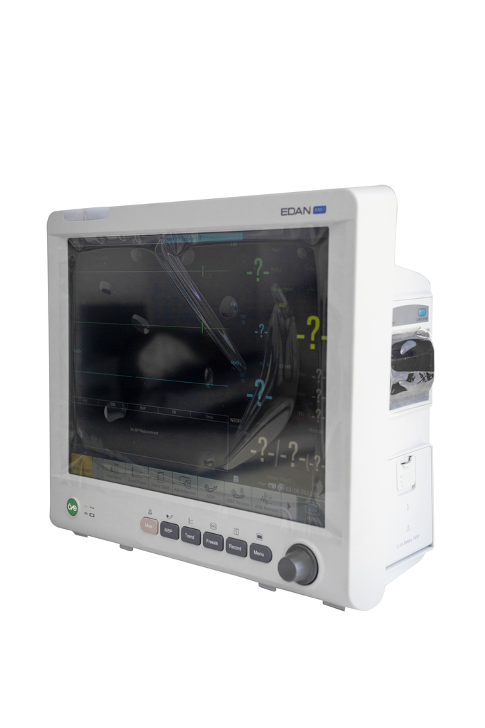 MONITOR EDAN – IMPORTADORA PERU